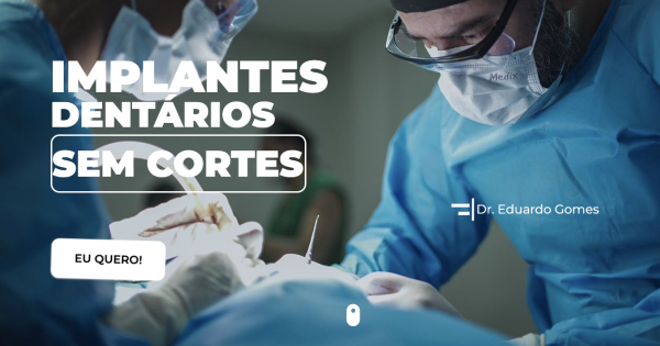 Implantes Sem Cortes - Clivix Odontologia